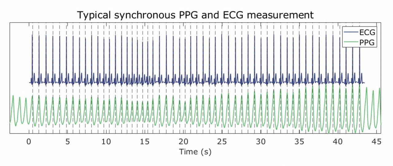 PPG Accuracy - Corsano Health